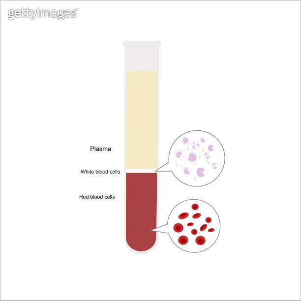 The peripheral or whole blood sample in test tube were separated in 3 ...