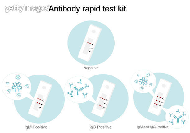 The result of antibody rapid test kit or lateral flow test ...