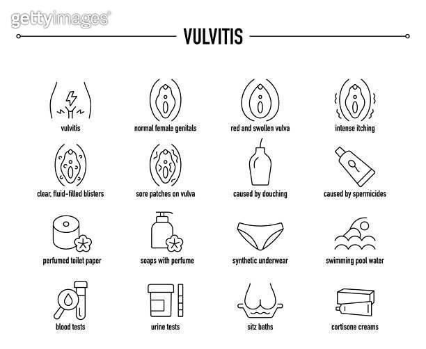 Vulvitis vector icon set 이미지 (1435259701) - 게티이미지뱅크