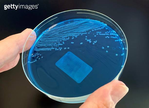 Enteroinvasive Escherichia coli (EIEC) 이미지 (1408506845) - 게티이미지뱅크