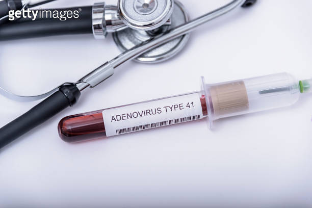 Childhood hepatitis. Blood sample tube for Adenovirus and Norovirus DNA ...