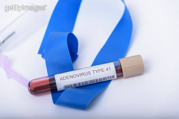 Childhood hepatitis. Blood sample tube for Adenovirus and Norovirus DNA ...