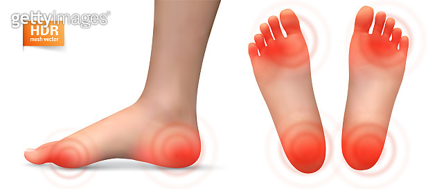 vector human foot.red spots of pain. ready element for medicine and ...