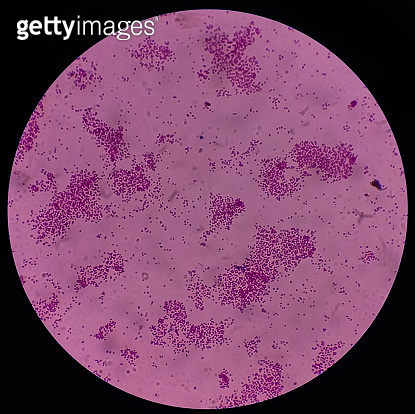 Gram stain, to differentiate bacterial species into two large groups ...