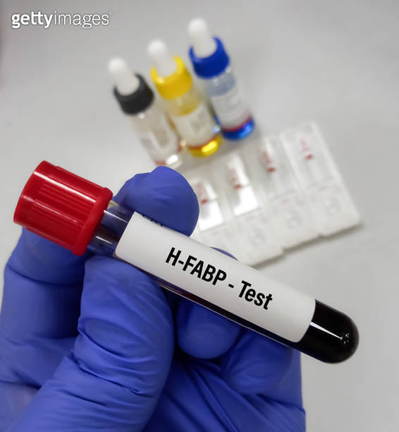 Blood sample for Heart-type fatty acid binding protein (H-FABP) blood ...