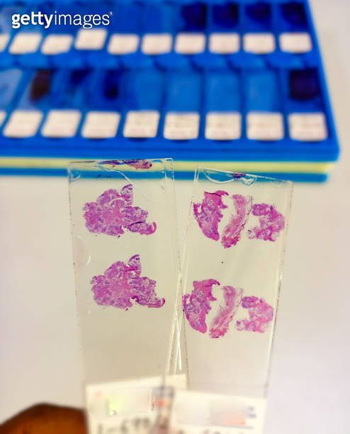 Close view of Histopathology slides stained with hematoxylin and eosin ...