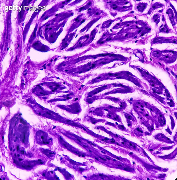 Prostate histology: Microscopic image of prostate gland tissue showing ...