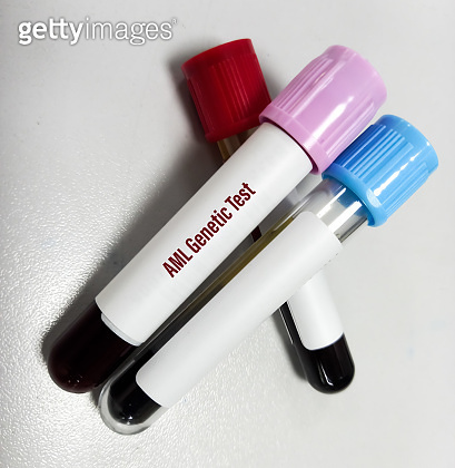 Blood sample for AML(Acute myeloid leukemia) genetic testing ...