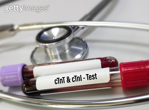 Blood sample for Troponin (cTnT and cTnI) test, diagnosis for ...