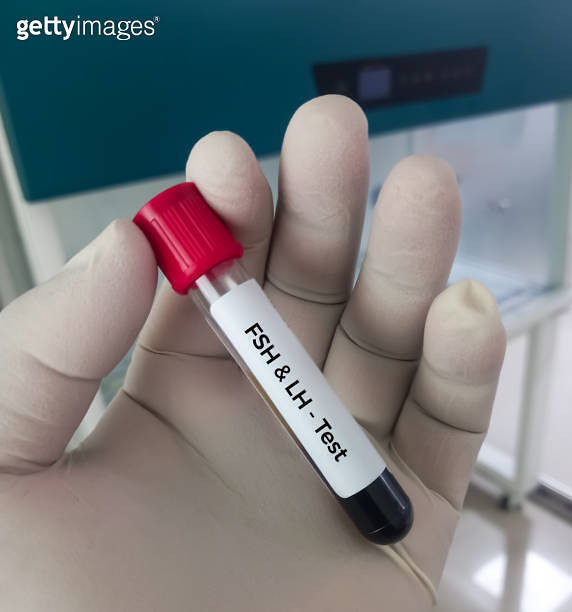 Blood sample tube for FSH, LH (Follicle Stimulating Hormone ...