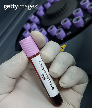 Medical technologist holding blood sample for Primary Immunodeficiency ...