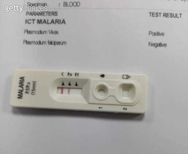 Rapid test kit for Malaria Ag (Pf,Pv) test, showing result plasmodium ...