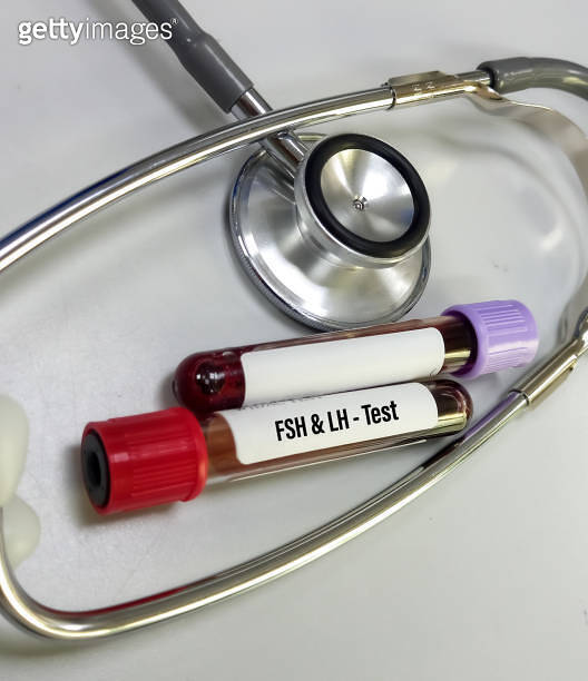 Blood samples for FSH, LH (Follicle Stimulating Hormone, Luteinizing ...