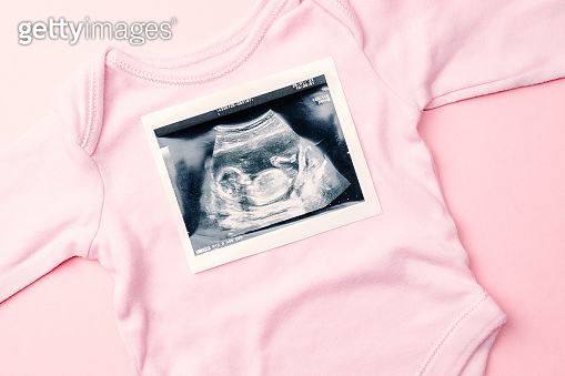 Ultrasound picture pregnant baby photo. Fashion cute baby cloth with ...
