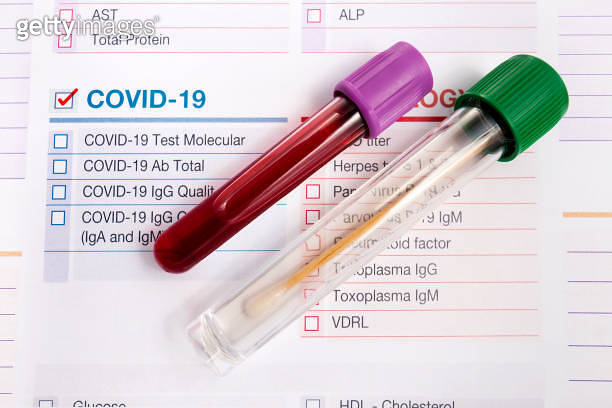 Blood tube and nasal swab laboratory test with requisition form for ...