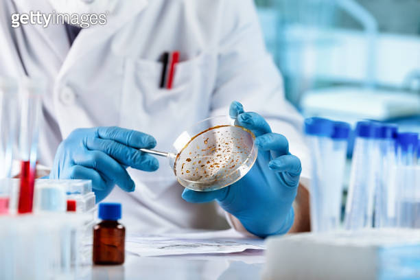Microbiologist working and examining mold and fungal cultures in petri ...