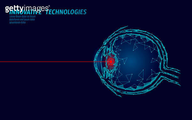 Laser vision correction medicine operation concept. Innovation ...