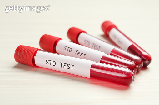 Tubes with blood samples and labels STD Test on white wooden table 이미지 ...