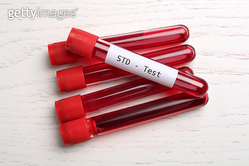 Tubes with blood samples on white wooden table, flat lay. STD test ...