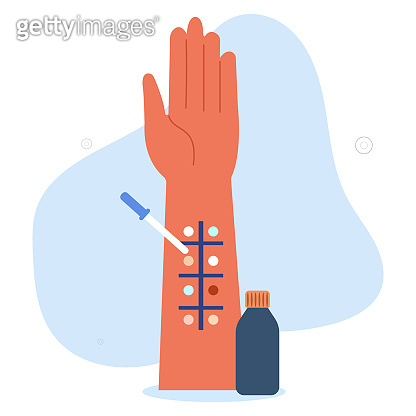 allergy skin test .Flat cartoon vector illustration. 이미지 (1441876670 ...
