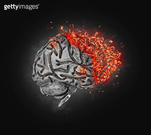 Mental state and bipolar disorder. Side view of a brain , exploded ...
