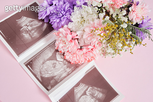 a snapshot of an ultrasound scan and flowers on a pink background ...