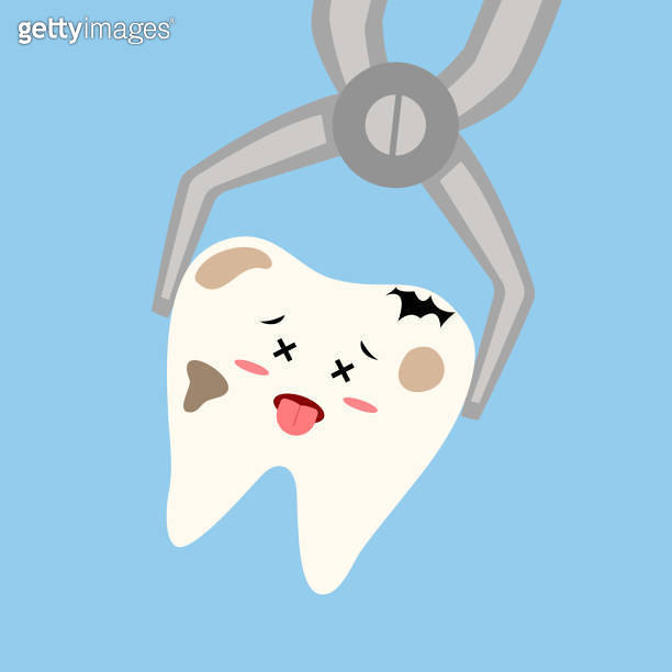 Tooth is removed by forceps. Cute cartoon of cavity tooth concept ...