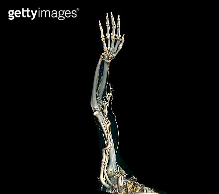 Brachial Arteries of the arm with Upper extremity Bone 3D rendering ...