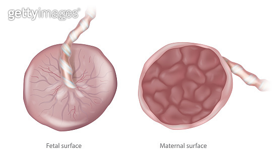 Placenta Maternal surface and Fetal surface. Biology of the Human ...