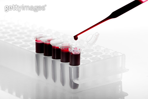 Pipette drop blood sample onto PCR tube or red liquid on PCR plate in ...