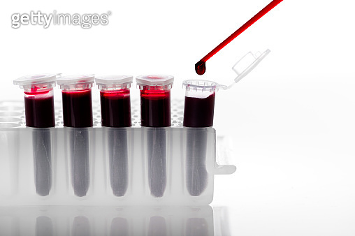 Pipette drop blood sample onto PCR tube or red liquid on PCR plate in ...