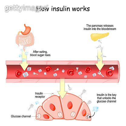 How insulin works. 이미지 (1410791412) - 게티이미지뱅크