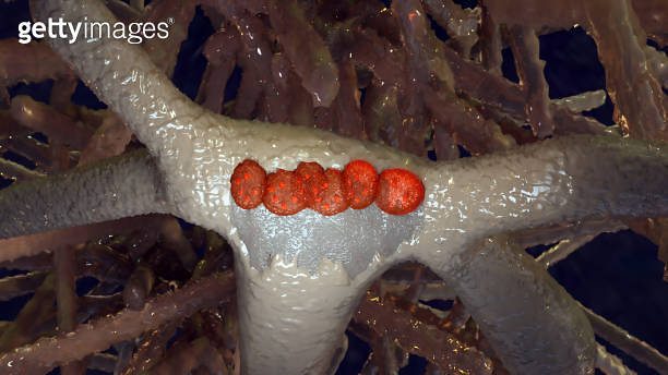 3d illustration of Osteoclaste, medically accurate, Bone modeling and ...