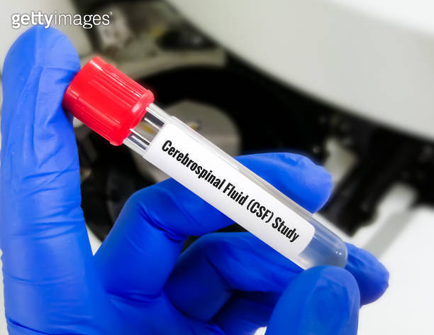 Cerebrospinal fluid (CSF) study including biochemistry, cytology, Gram ...