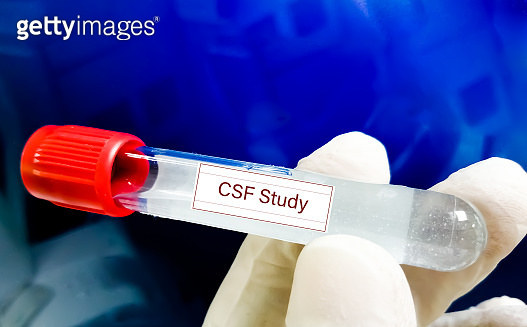 Cerebrospinal fluid (CSF) study including biochemistry, cytology, Gram ...