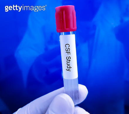 Cerebrospinal fluid (CSF) study including biochemistry, cytology, Gram ...