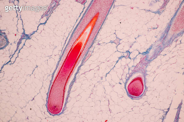 Scalp and hair follicles of human under the microscope in Lab ...