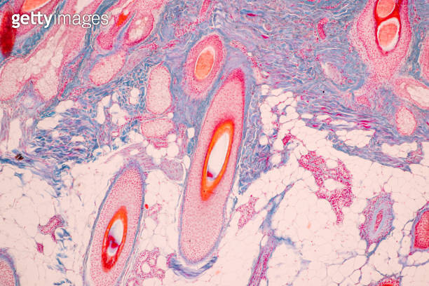 Scalp and hair follicles of human under the microscope in Lab. 이미지 ...