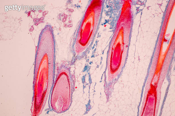Scalp and hair follicles of human under the microscope in Lab. 이미지 ...