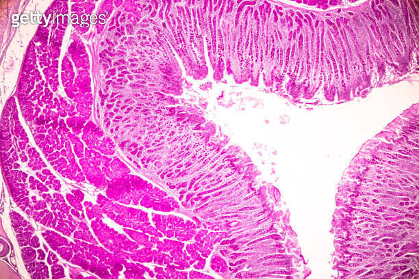 Tissue of Small intestine (Duodenum) and Vermiform appendix Human under ...