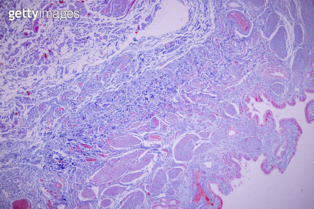 Columnar epithelium of human gall bladder under the microscope in Lab ...
