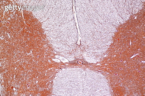 Motor Neuron and nerve cells under the microscope in Lab. (1365098804 ...