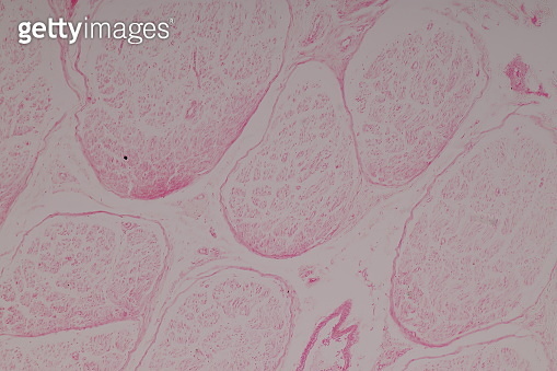 Motor Neuron and nerve cells under the microscope in Lab. (1365098734 ...