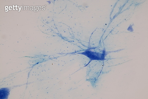 Motor Neuron and nerve cells under the microscope in Lab. 이미지 ...