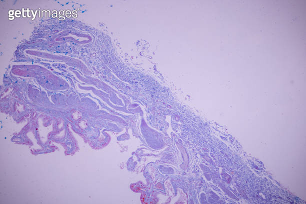 Columnar epithelium of human gall bladder under the microscope in Lab ...