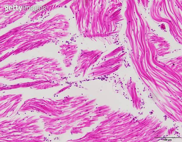 Animal tissue samples under the microscope in Lab. 이미지 (1368148603 ...