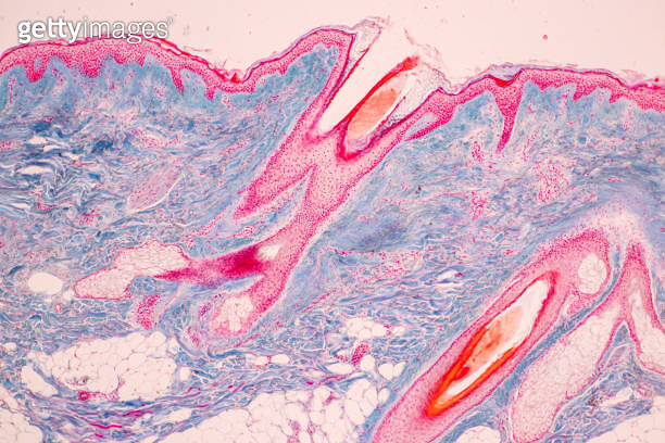 Scalp and hair follicles of human under the microscope in Lab ...