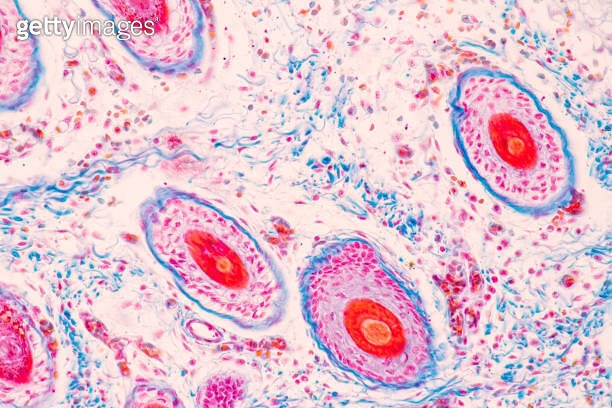 Scalp and hair follicles of human under the microscope in Lab. 이미지 ...