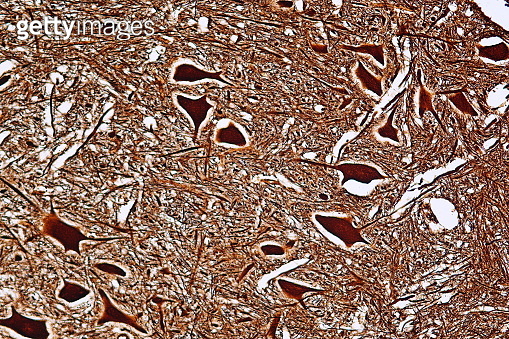 Motor Neuron and nerve cells under the microscope in Lab. (1365098893 ...