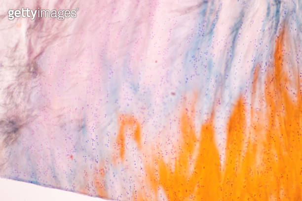 White fibrous cartilage of human under the microscope in Lab ...